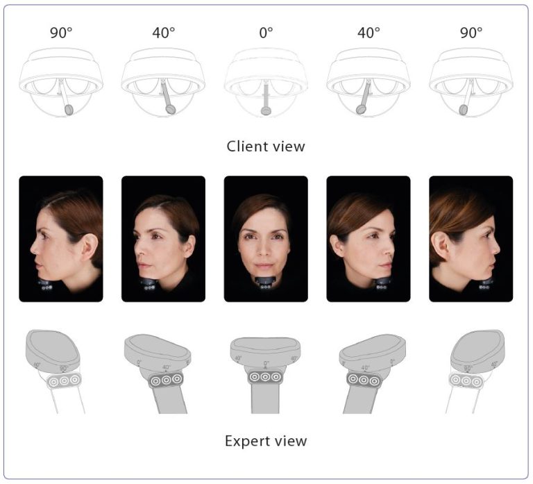 OBSERV 520X - Skin analysis | Dentist Nottingham | Facial Aesthetics