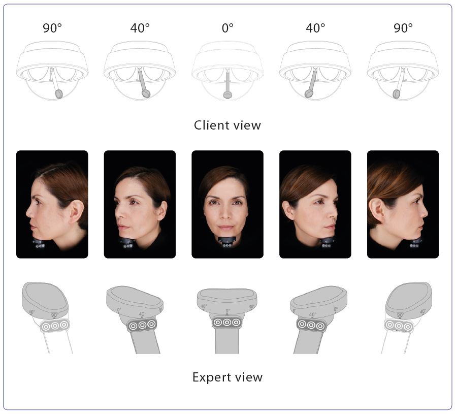 OBSERV 520X - Skin analysis | Dentist Nottingham | Facial Aesthetics